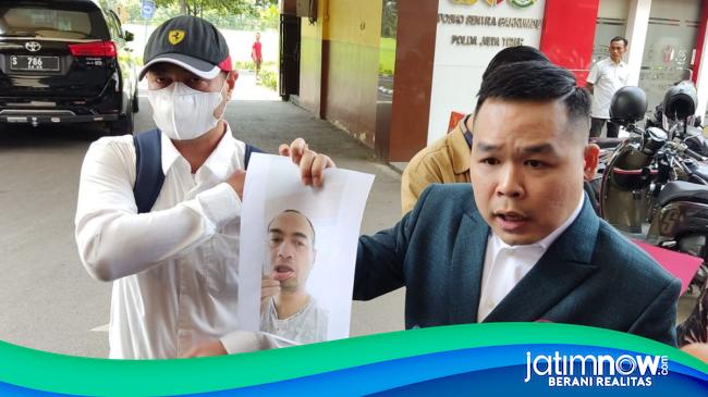 Ferry Irawan Curhat Dicakar Venna Melinda hingga Bibirnya Berdarah