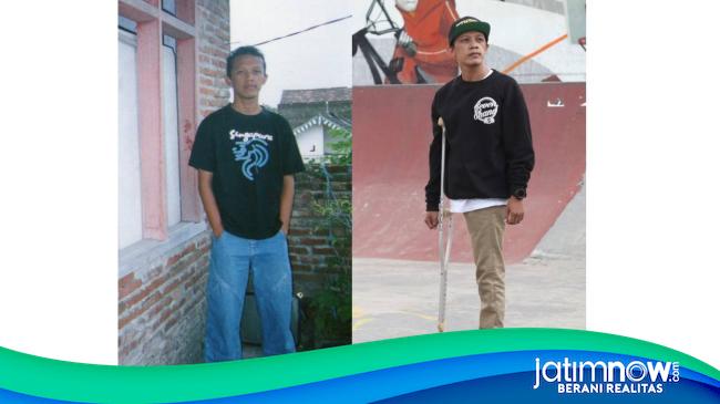 Pria Asal Malang Tetap Semangat Breakdance Walau Hanya Berkaki 1, Luar ... Pria Asal Malang Tetap Semangat Breakdance Walau Hanya Berkaki 1, Luar ...